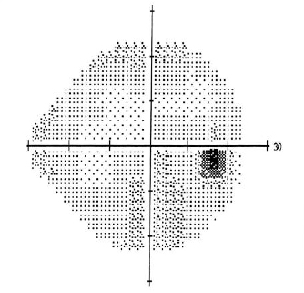Ophthalmic Professional | PentaVision