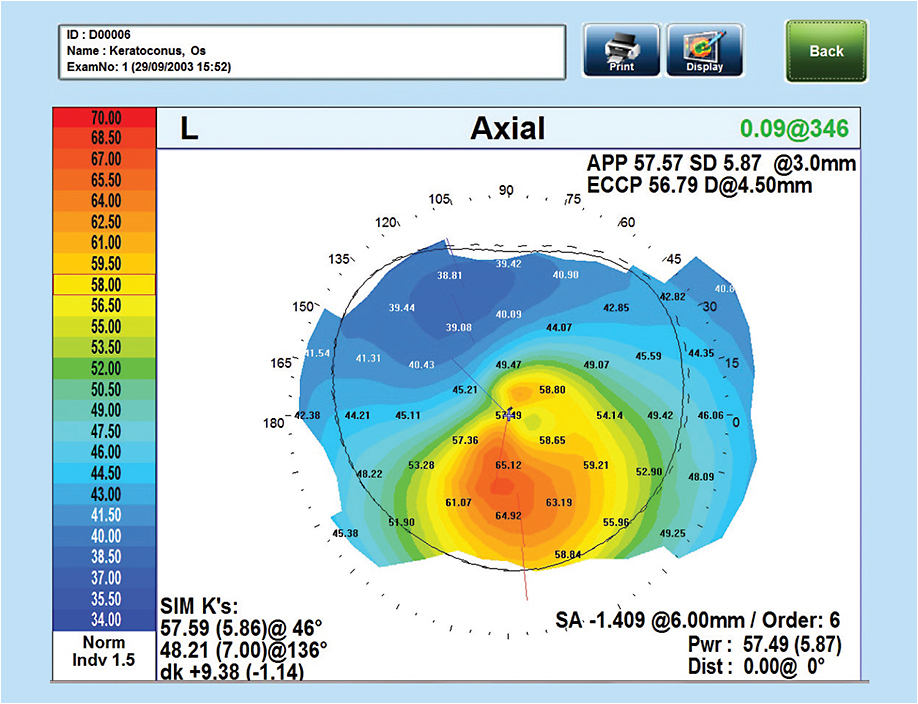 Ophthalmic Professional | PentaVision