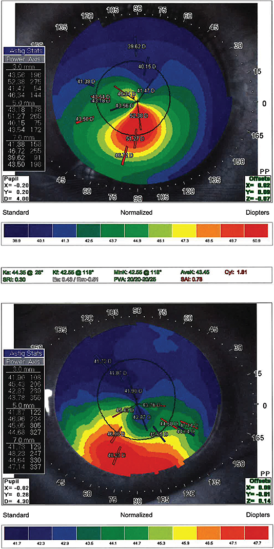 Ophthalmic Professional | PentaVision