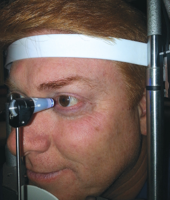 Ophthalmic Professional | PentaVision