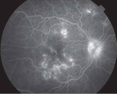 Ophthalmic Professional | PentaVision