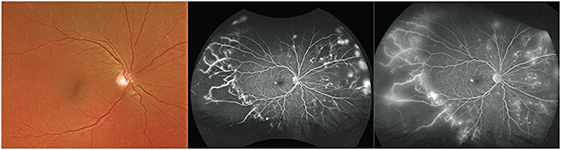 Ophthalmic Professional | PentaVision