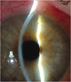 Ophthalmic Professional | PentaVision