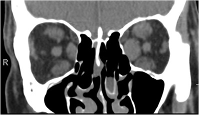Ophthalmic Professional | PentaVision